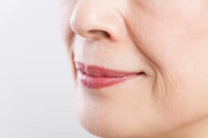 ¿Que es el surco nasogeniano?¿El mejor tratamiento? - Centro Médico El ...